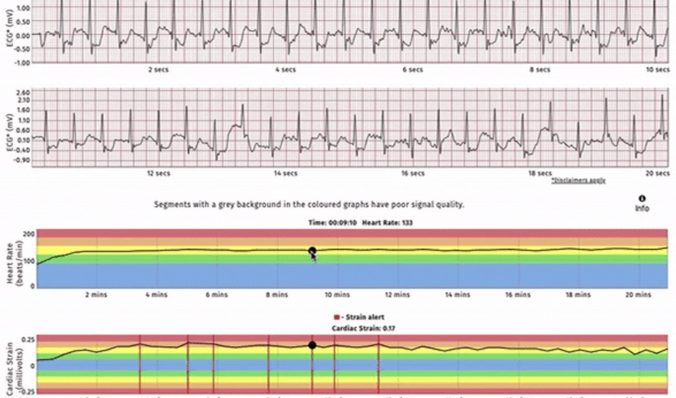 ECG graphs - AW